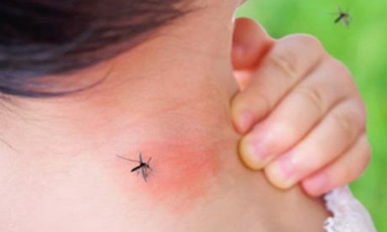La explicación de porqué los mosquitos pican a los humanos desde hace ...