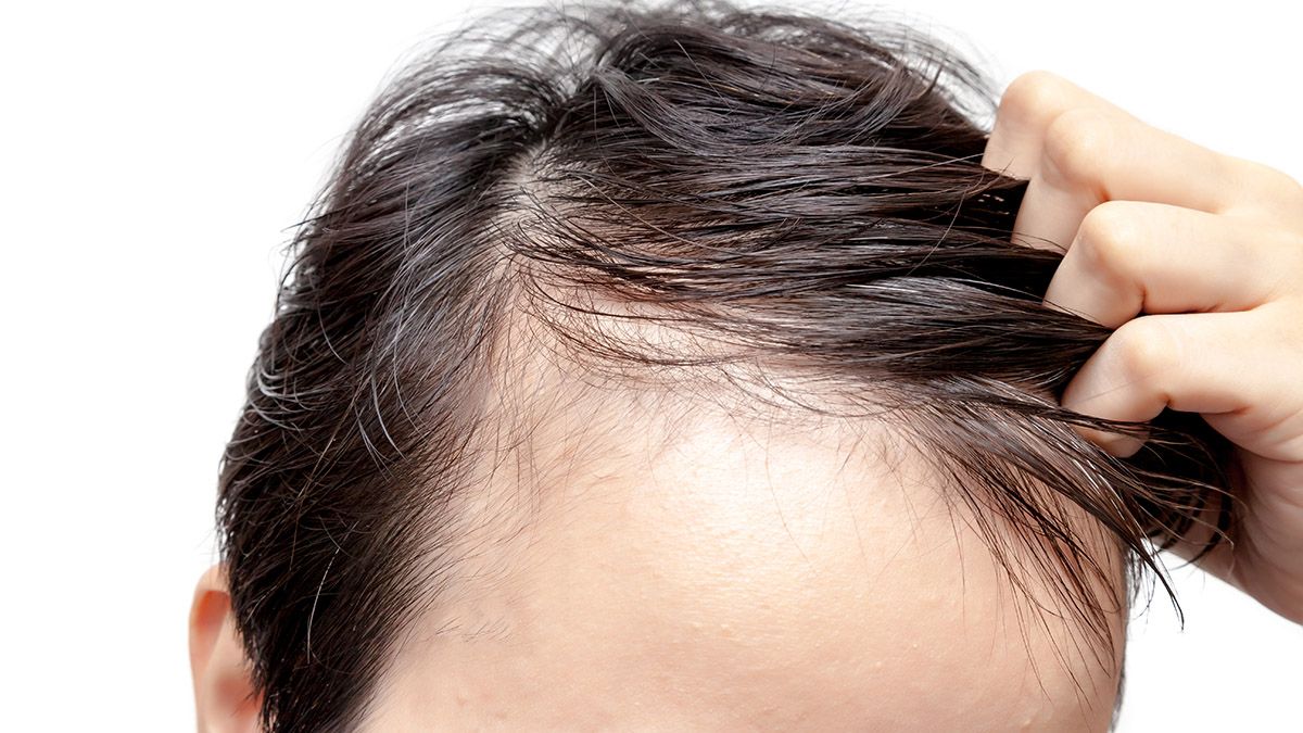 Cómo combatir la caída de cabello de forma eficaz y segura