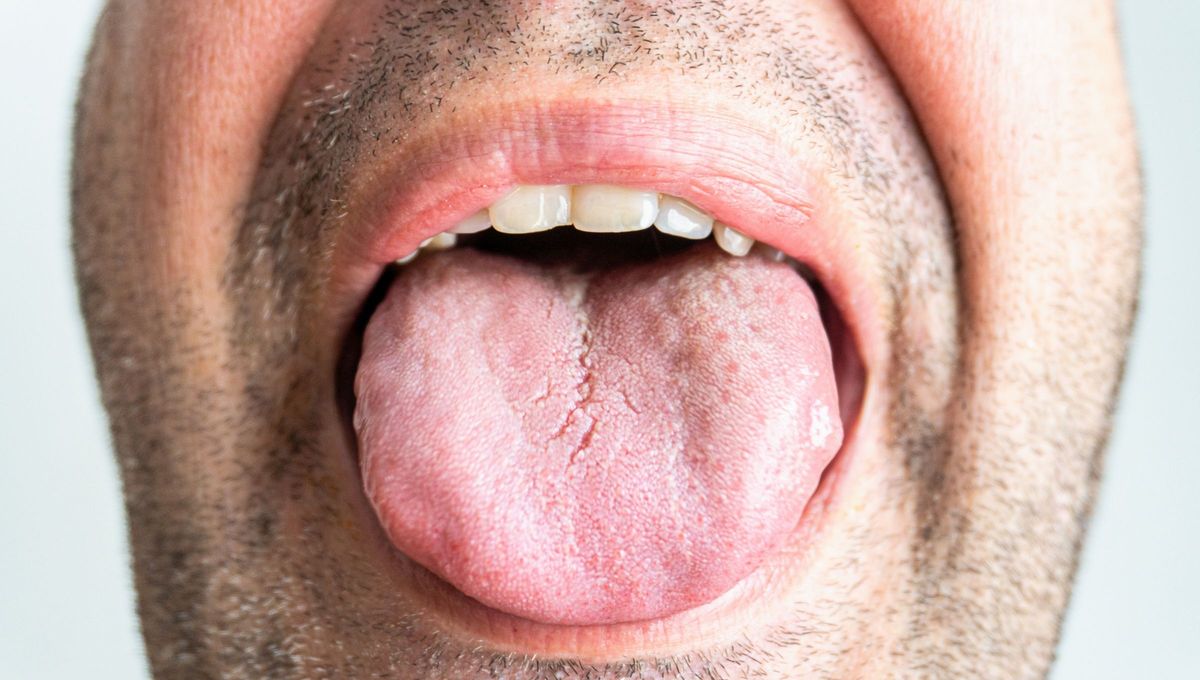 Revela mucho sobre tu salud: qué significa tener la lengua con grietas