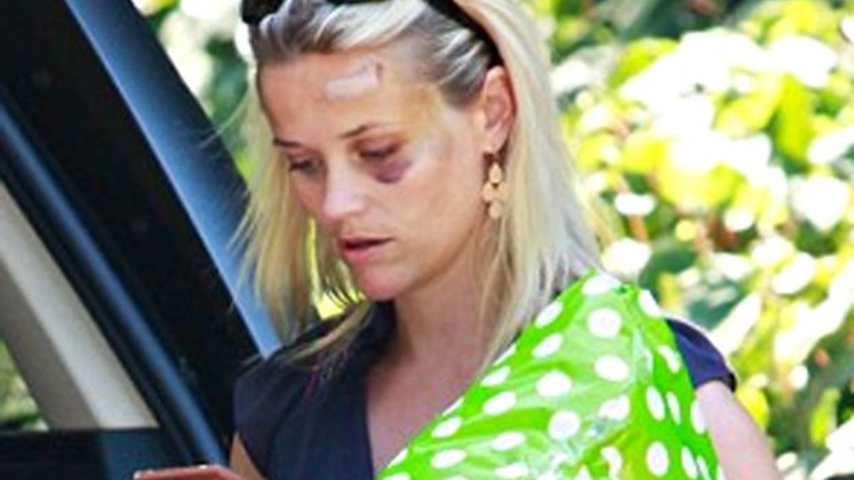 Así quedó tras el accidente