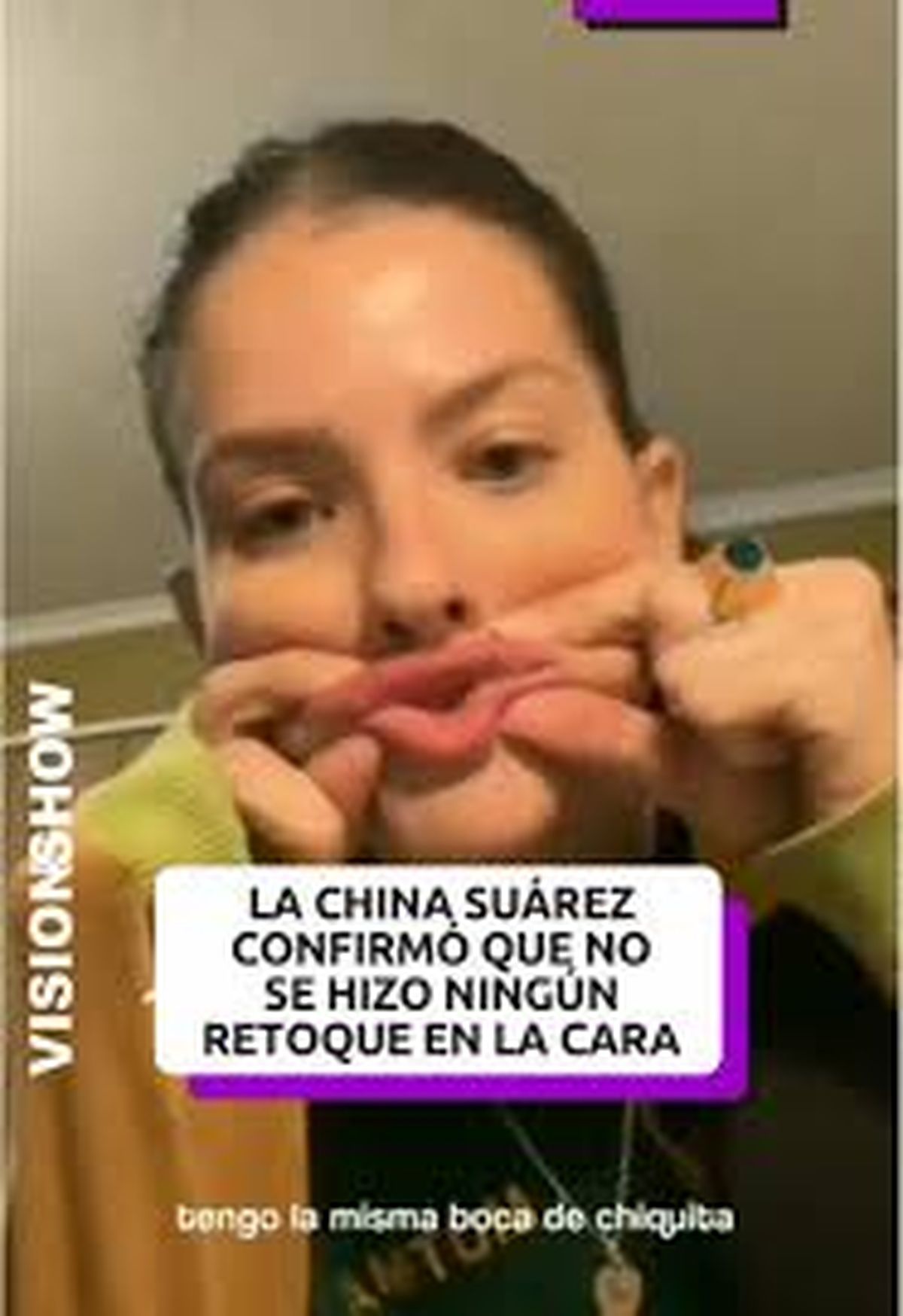 Qué se hizo la China Suárez en su cara: Hay que mover todo