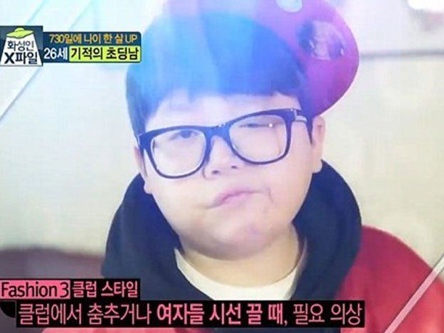 Síndrome de Highlander: tiene 26 años y parece de 10