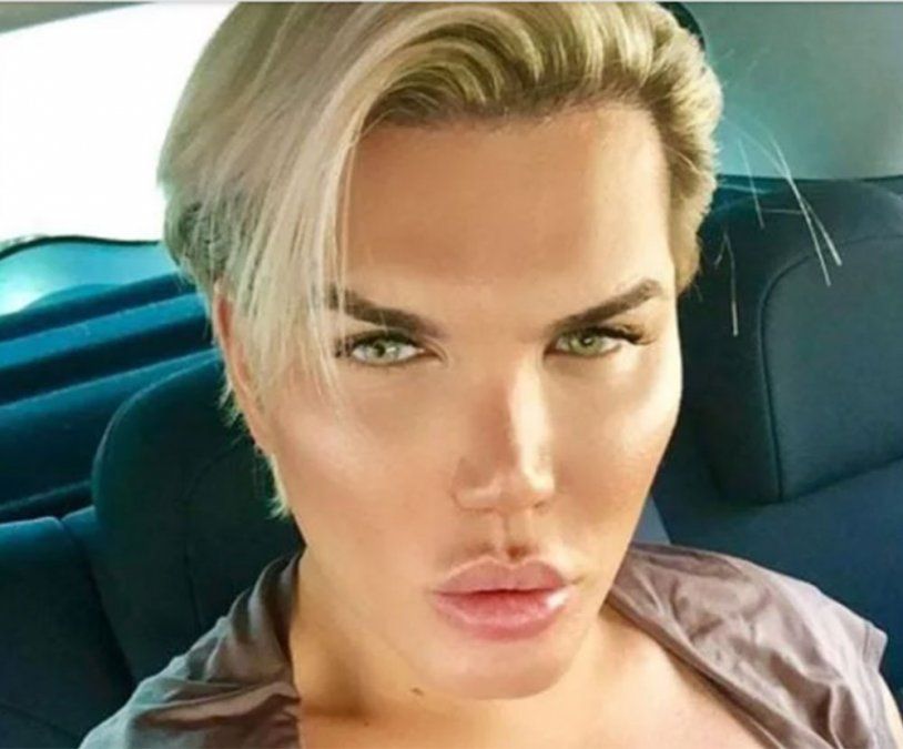 El Ken Humano recibió un doloroso diagnóstico médico