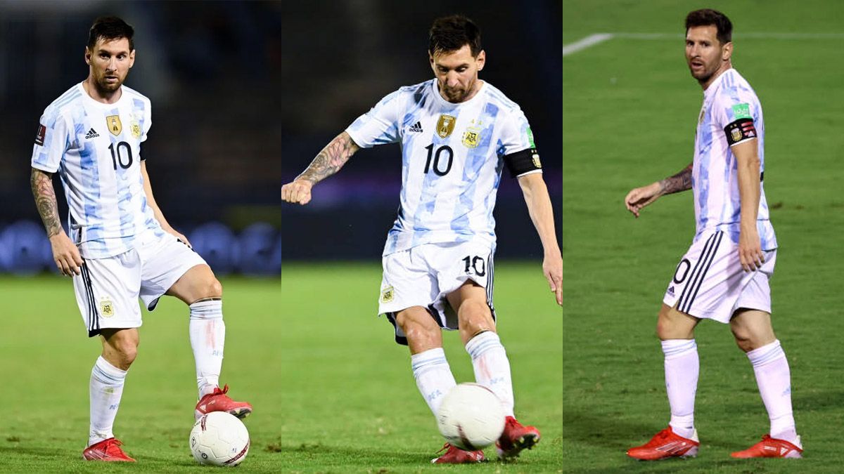 Así le quedó la pierna a Messi tras la escalofriante patada