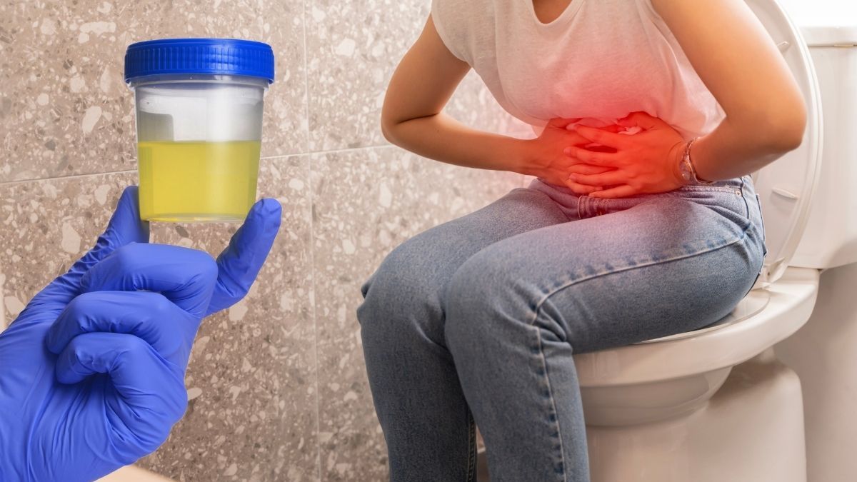 Orina con espuma: ¿Qué enfermedad se esconde detrás?