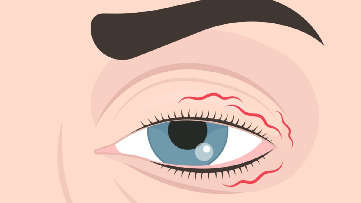 Toma nota para saber cómo evitar el temblor en los ojos y cuales son ...