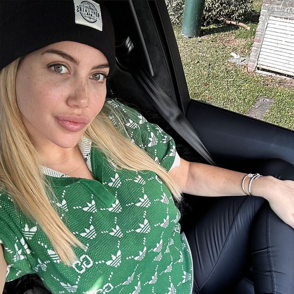 Wanda Nara rompió el silencio y habló de su salud