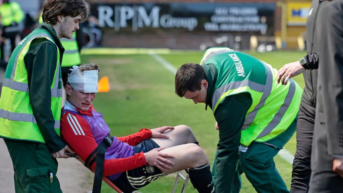 Violencia en el fútbol: un hincha desfiguró a un jugador y fue ...