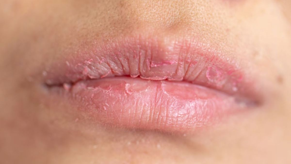 Que significa sacarse los pellejos de los labios