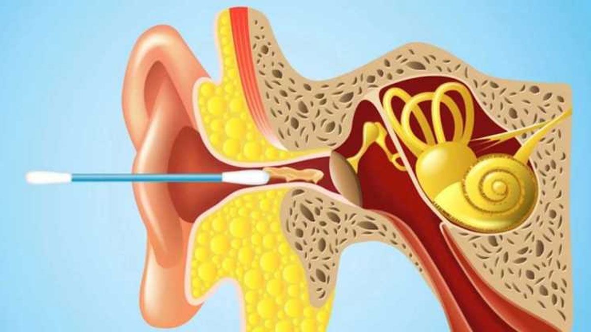 Toma asiento al saber lo peligroso que es limpiarse los oídos con un hisopo