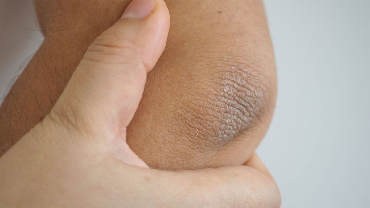 Codos negros y secos: el truco casero para recuperarlos y que no se ...