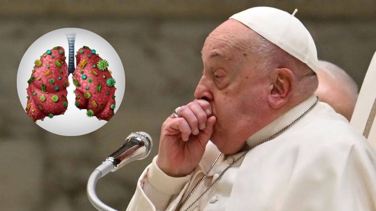 Qué es la neumonía bilateral, la enfermedad que afectó al Papa Francisco