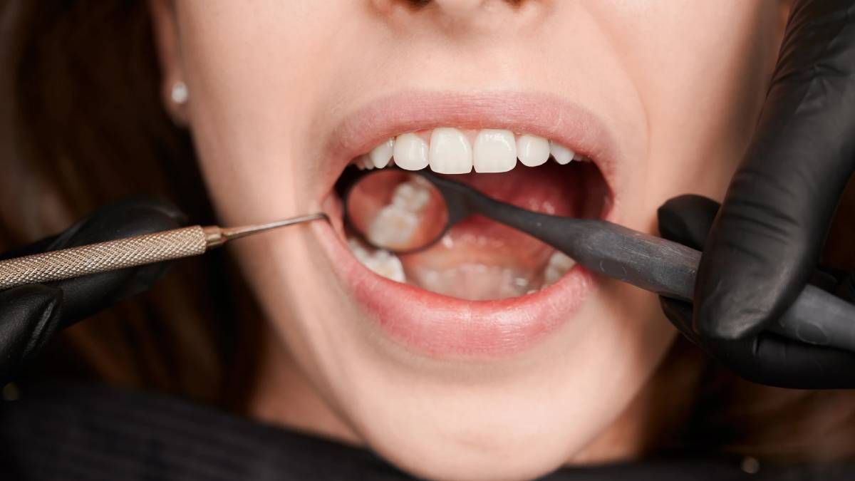 Qué significa tener los dientes cariados, según la biodescodificación