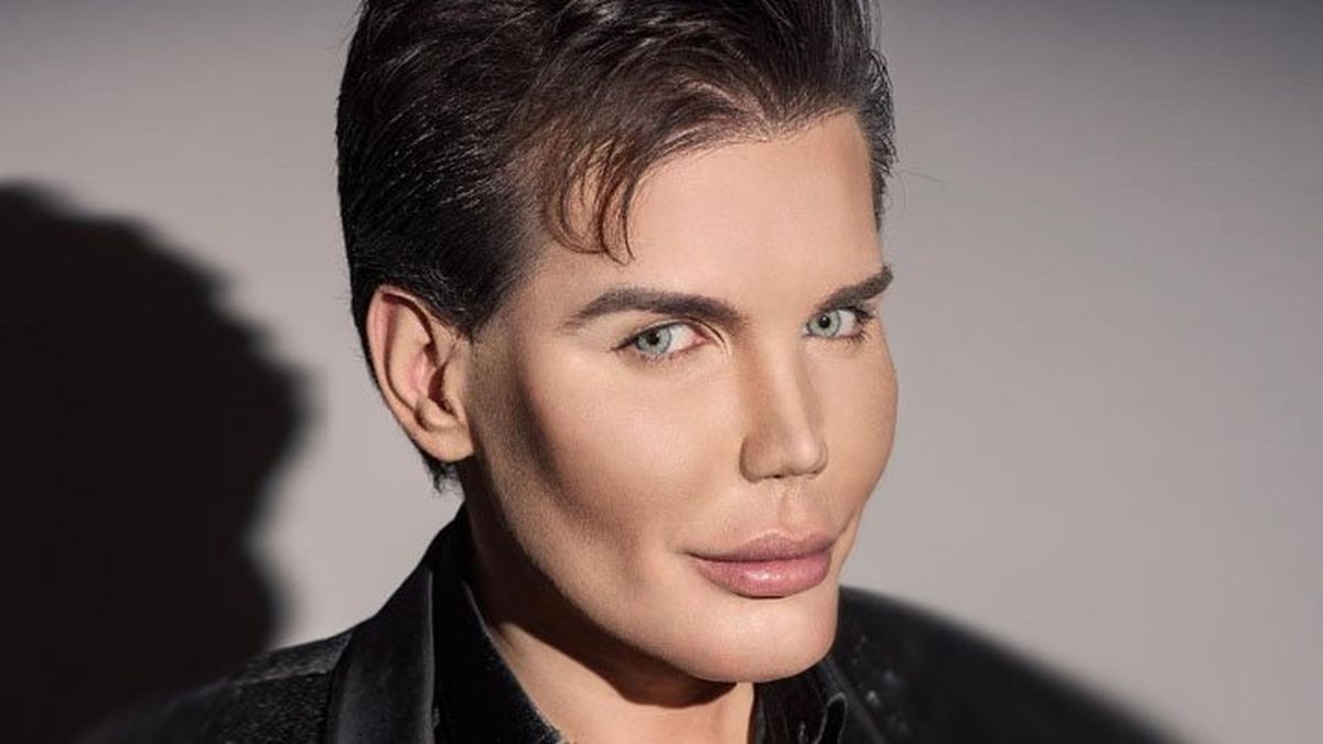 Así está el Ken humano tras su cirugía número 50