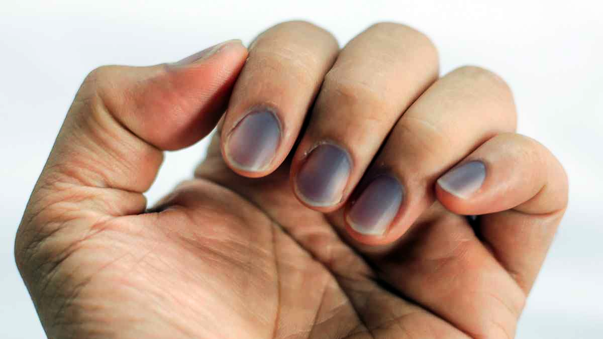 Uñas azules: qué significan según la medicina