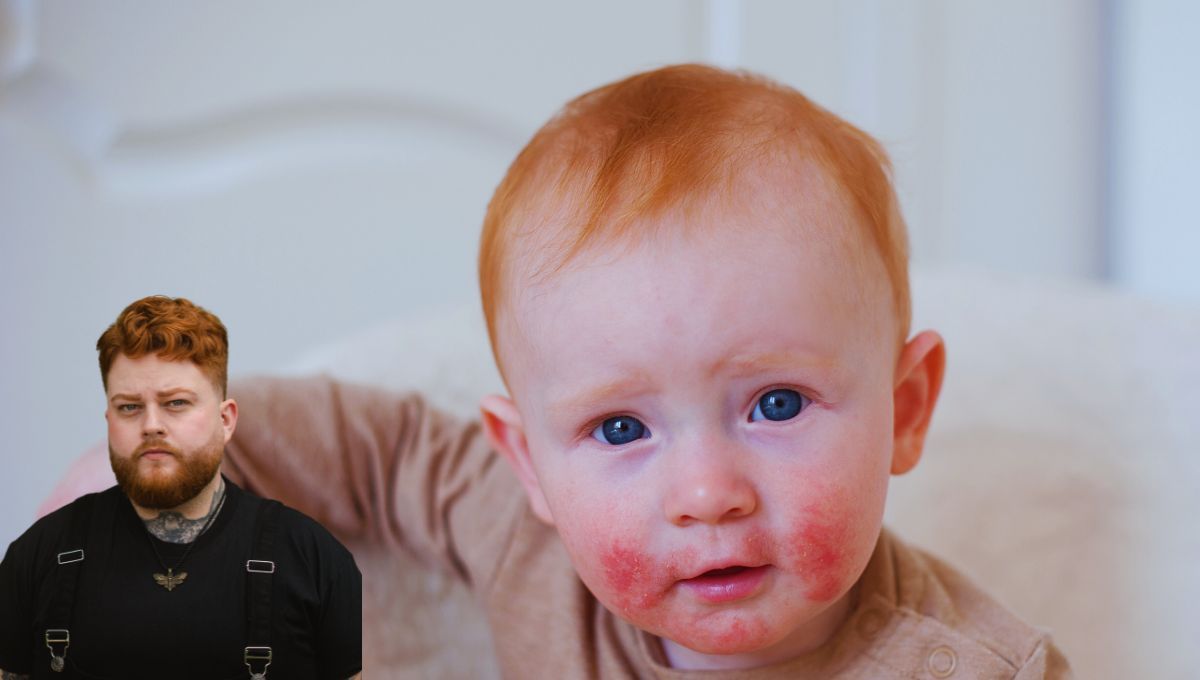 ¿Cuál es el significado de que nazca una persona pelirroja en el árbol ...