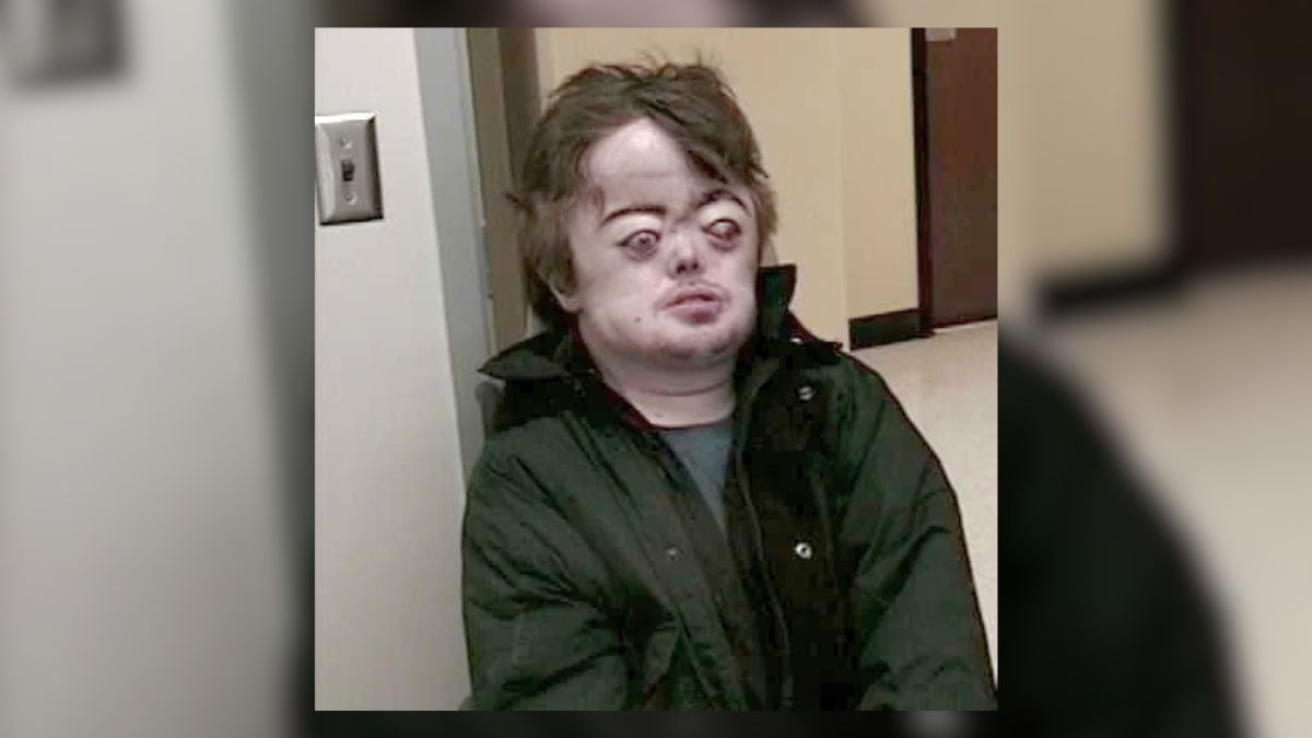 La historia detrás del extraño rostro de un agresor sexual que se hizo viral