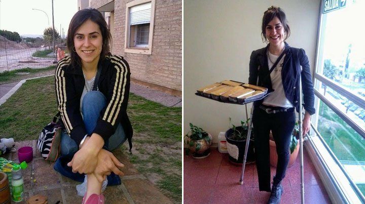 María Emilia Correa, la joven que lucha por una prótesis