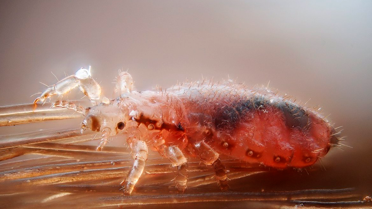 Qué significa soñar con piojos