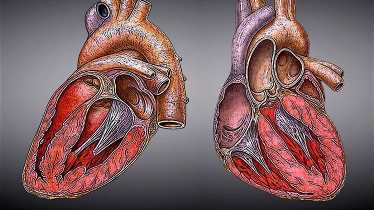 Un nuevo stent cura el corazón y desaparece