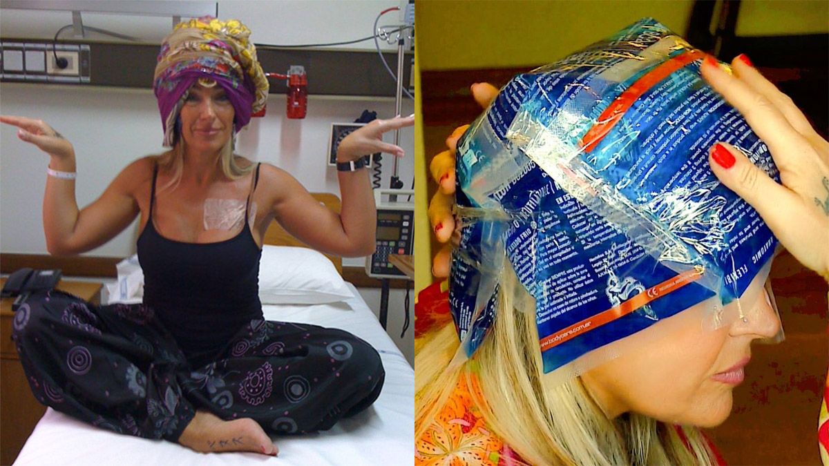 Quimio: cómo no perder el pelo durante el tratamiento