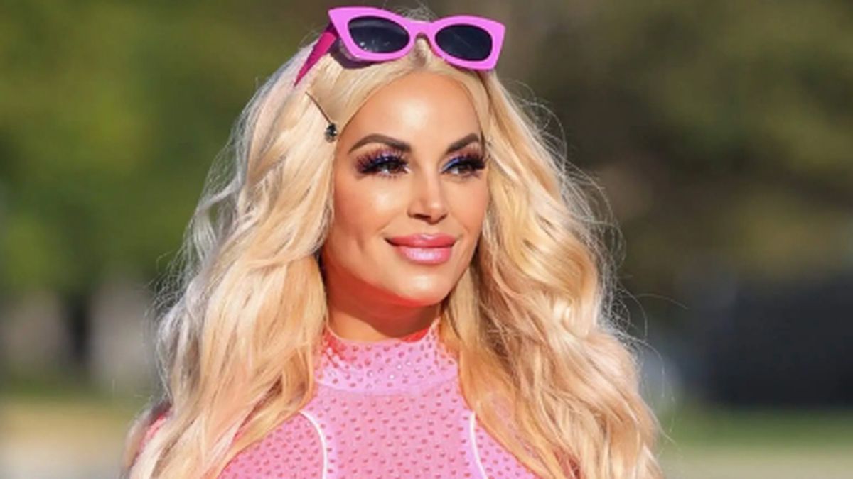 La Barbie humana de Argentina: fotos antes y después de las cirugías ...