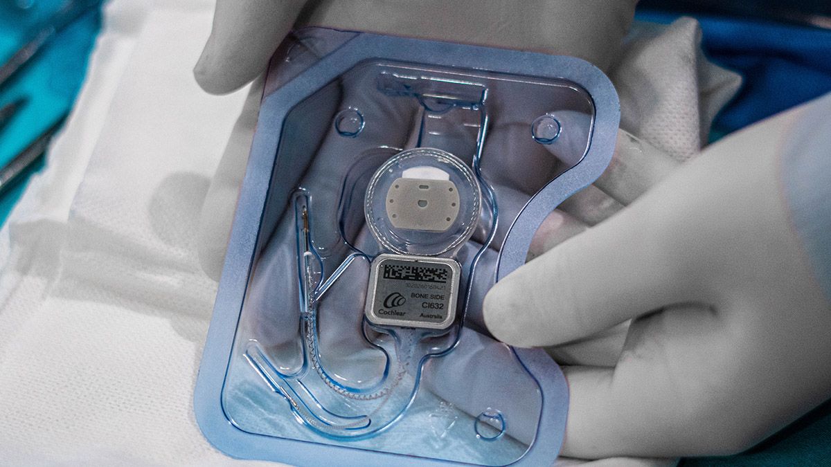 Volver a escuchar: moderna tecnología en implantes cocleares
