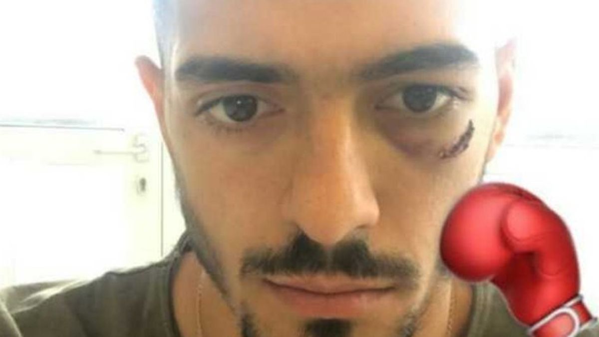 ¿Ahora es boxeador? Mirá cómo le quedó el ojo al ex River