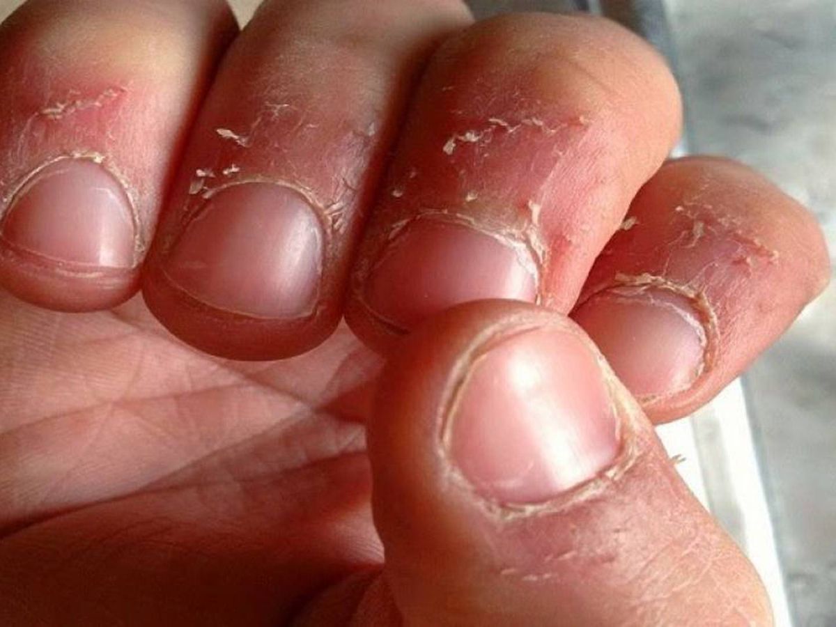 Elimina los padrastros de tus uñas sin dolor y en pocos segundos