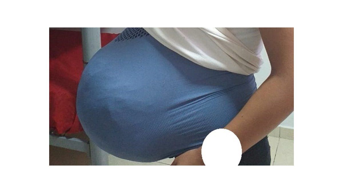 Narco embarazo: en una panza falsa escondía 15 paquetes de marihuana