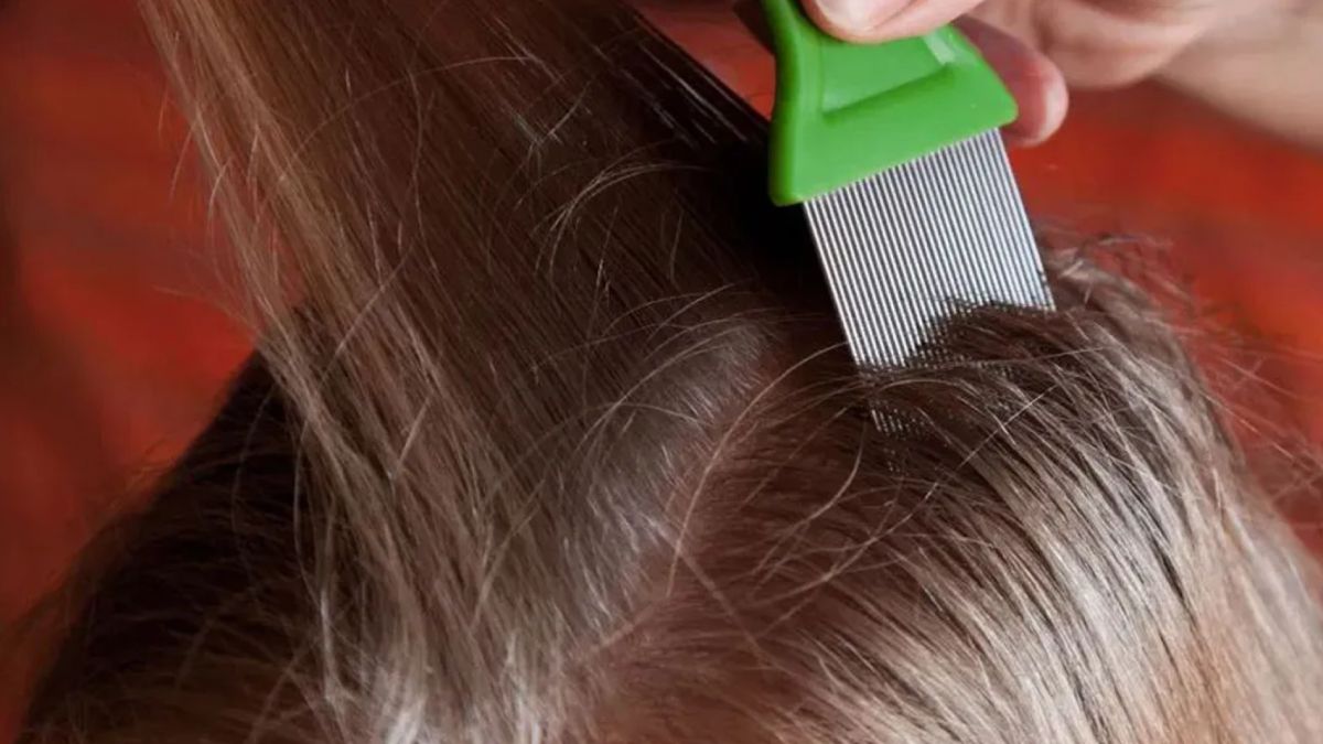 Trucos caseros naturales para eliminar piojos para siempre