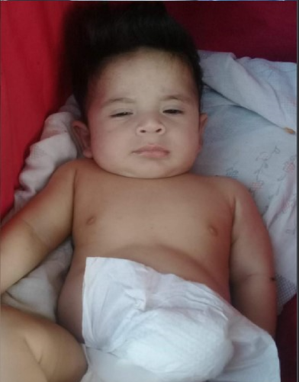 El duro calvario que vivió Benjamín, el nene de 3 años, antes de ser ...